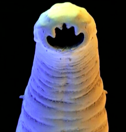 Kill or Cure - Hookworm Invader - SWPictures